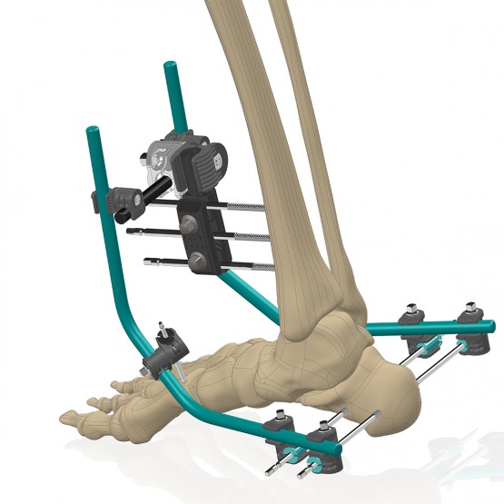 Medical design - JPP Médical