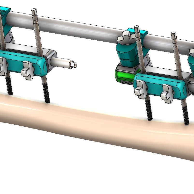 Medical design - JPP Médical
