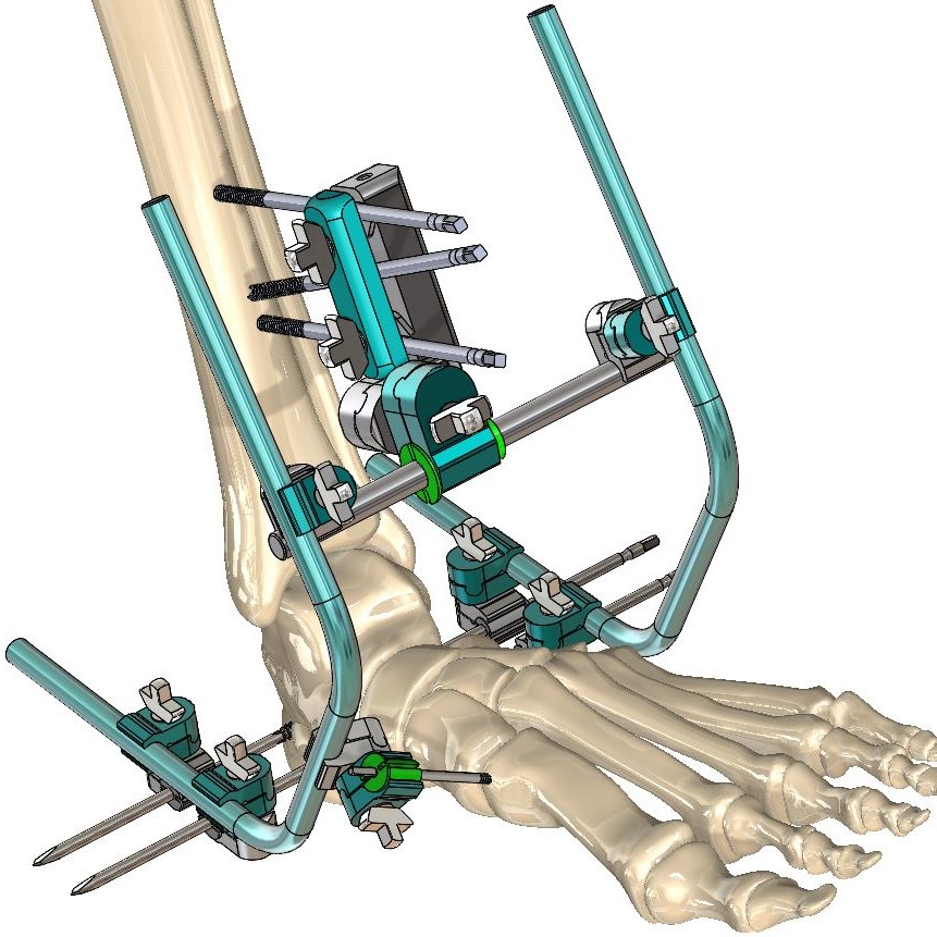 Medical design - JPP Médical