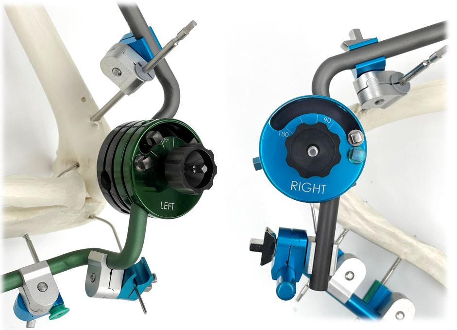 D.E.F. Dynamic Elbow Fixator. - JPP Médical