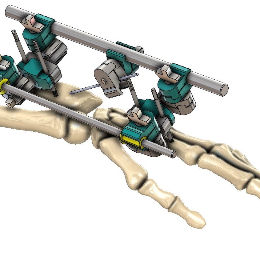 Medical design - JPP Médical